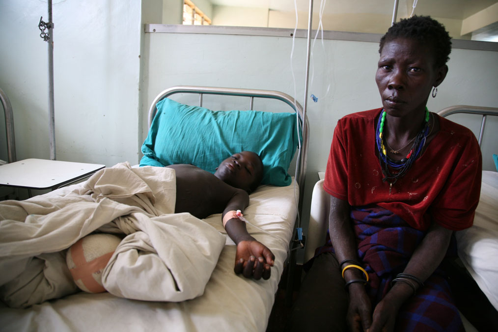 Igira Maria sits with her young son Logel who had his leg amputated ...
