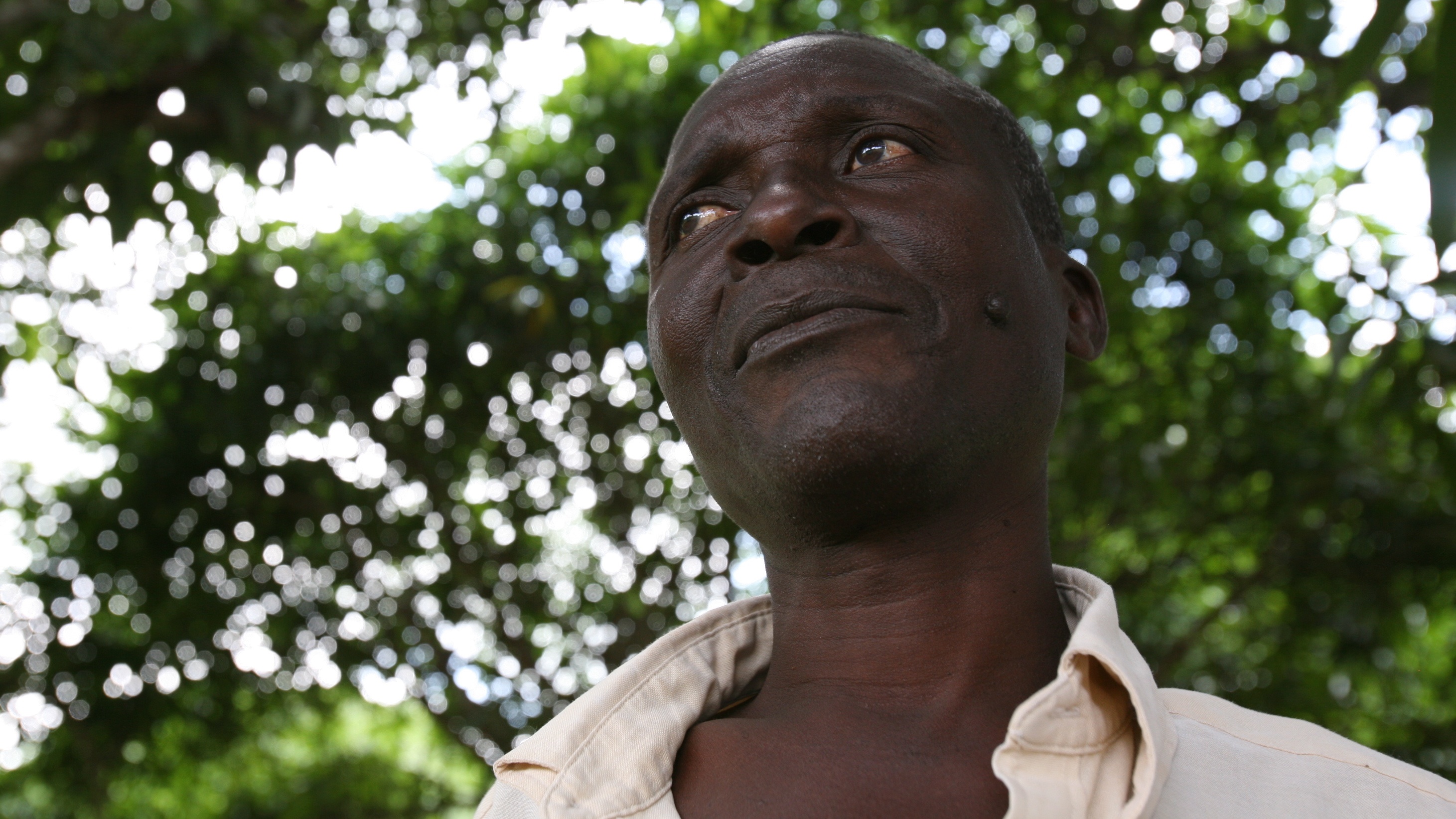 A man suffering from Elephantiasis | Health | The New Humanitarian