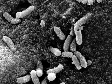 Pneumonia virus | Health | The New Humanitarian